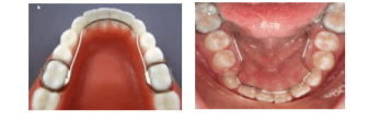KWR Orthodontic Patient Information Sheet - Koowerup Dental Surgery